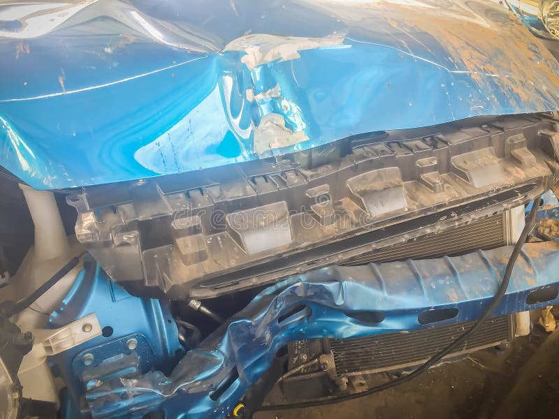Close-up Front of Blue New Car Distorted by Accident. Crashed Ne Stock ...