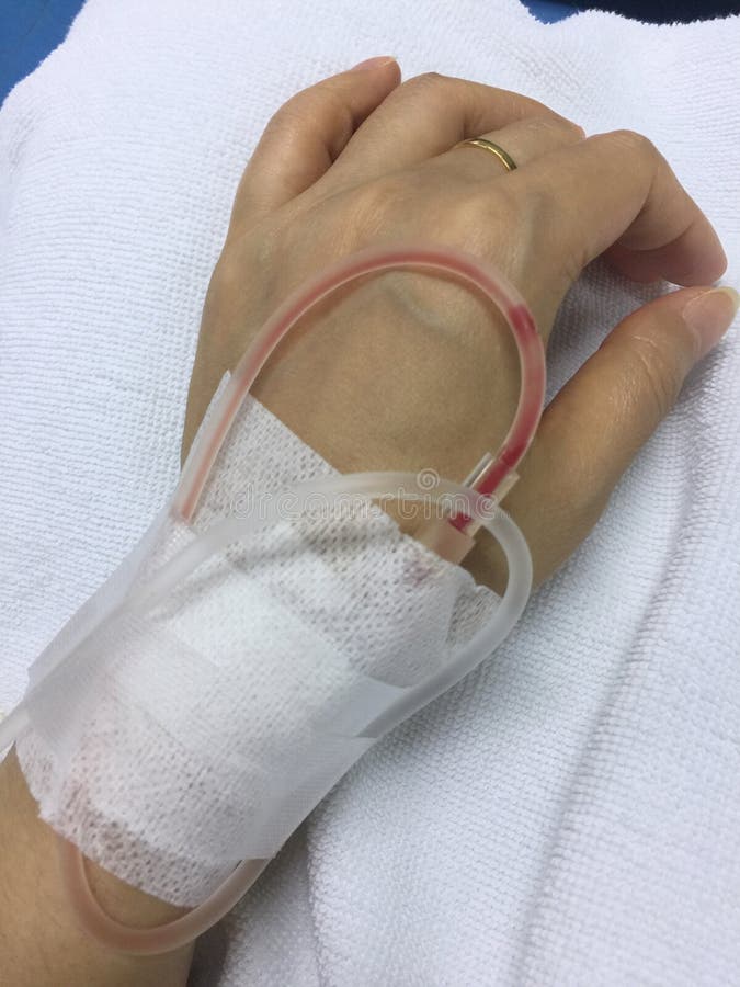 Iv Drip In Woman Patient's Hand Stock Photo - Image of healing ... Iv Drip In Woman Patient's Hand Stock Photo - Image of healing ...