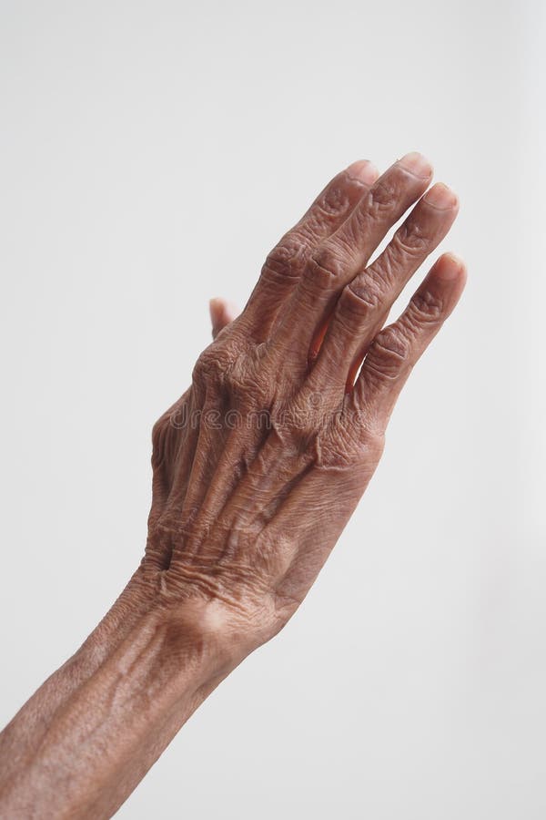 Close-up of a Hand Revealing the Beauty of Aged Skin Textures Stock ...