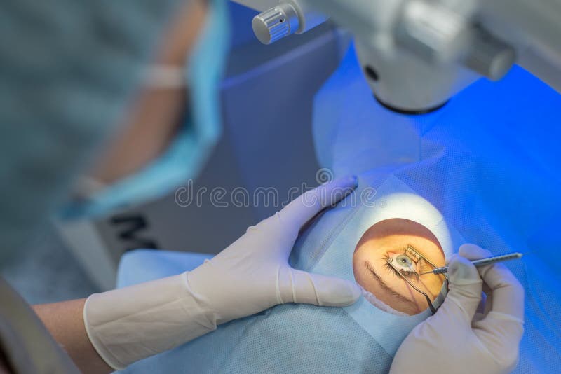 A Close-up of the Hands of an Ophthalmologist Surgeon Looking through a ...