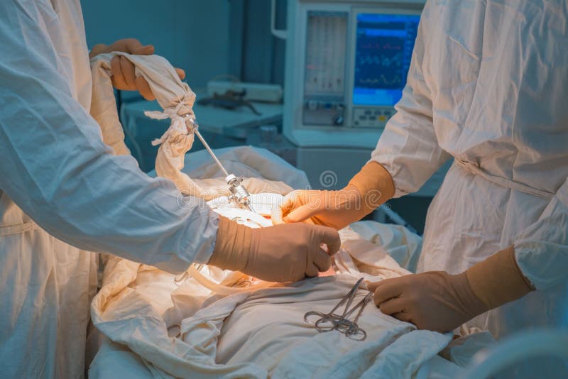 Close-up Hands of Pediatric Surgeons Perform Surgery Using Laparoscopic ... Close-up Hands of Pediatric Surgeons Perform Surgery Using Laparoscopic ...