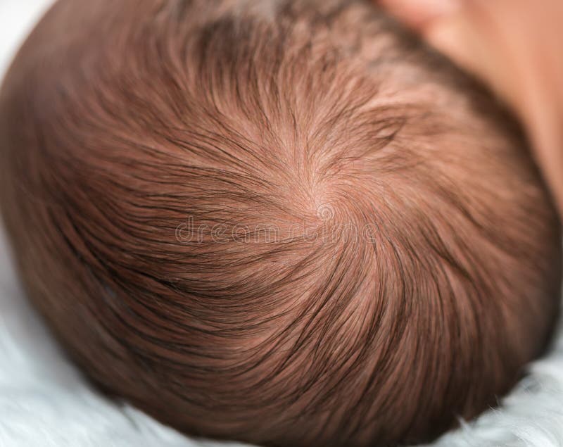 156 Baby Dandruff Stock Photos - Free & Royalty-Free Stock Photos from ...