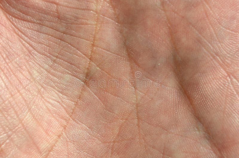 Close Up of Human Hand Skin with Visible Skin Texture and Lines Stock ...