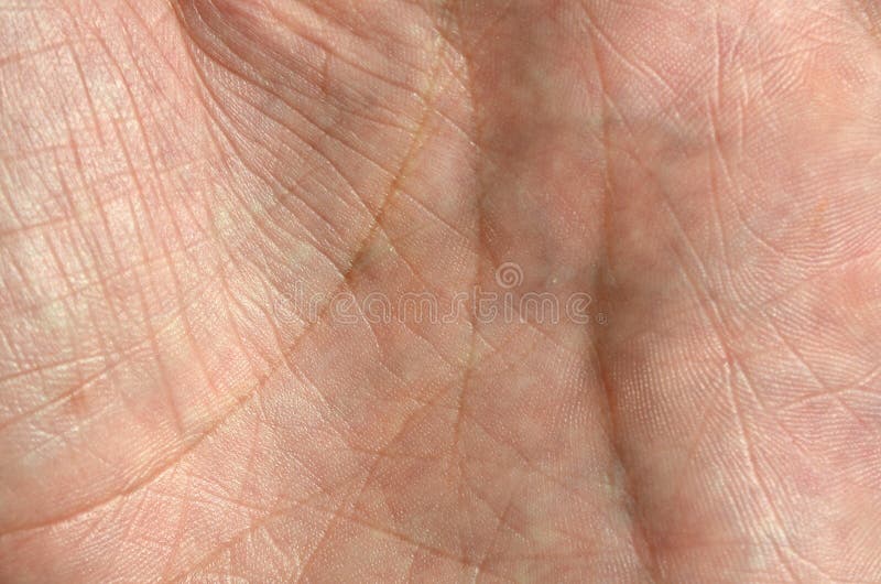 Close Up of Human Hand Skin with Visible Skin Texture and Lines Stock ...