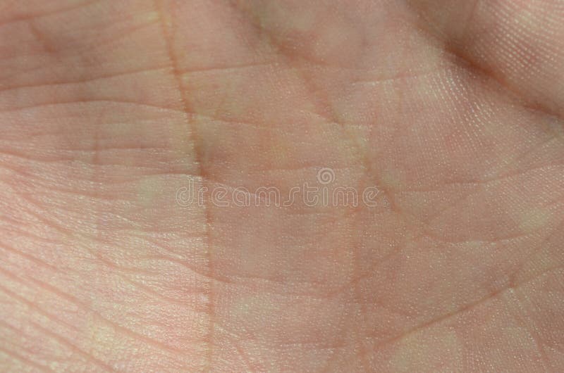 Close Up of Human Hand Skin with Visible Skin Texture and Lines Stock ...