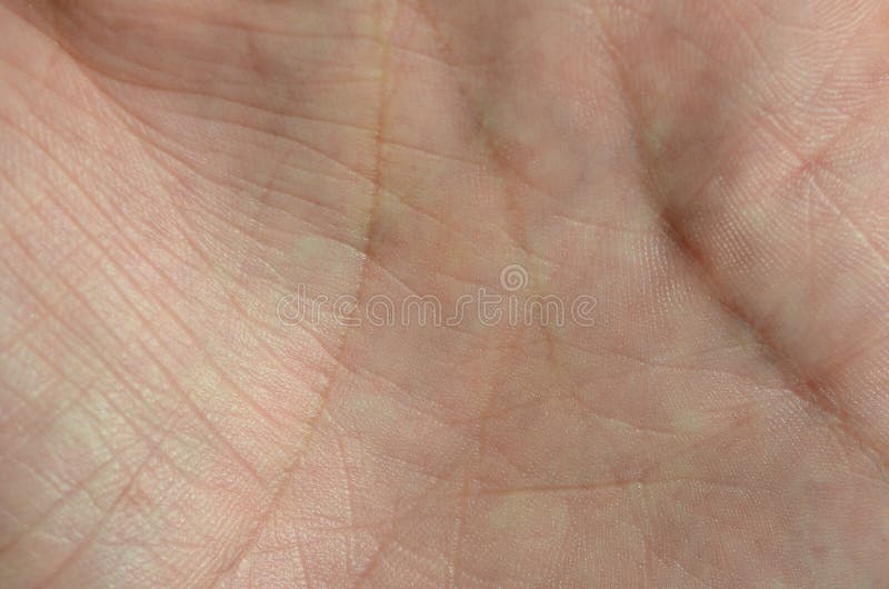 Close Up Of Human Hand Skin With Visible Skin Texture And Lines Stock ...