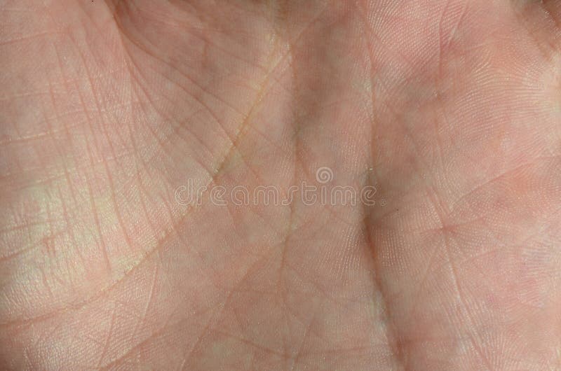 Close Up of Human Hand Skin with Visible Skin Texture and Lines Stock ...