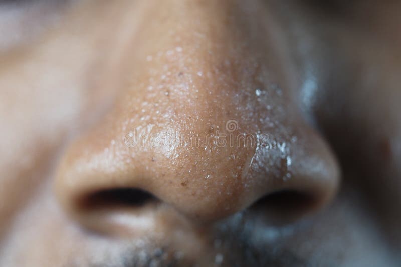 Close up of human nose, stock photo. Image of sick, oily - 356593968
