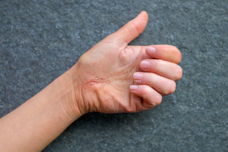 489 Injured Hand Cut Blood Stock Photos - Free & Royalty-Free Stock ...