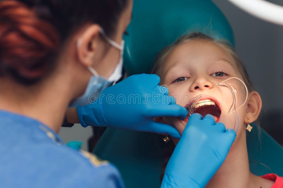 Close-up of the Installation of a Retractor on the Lips of a Child ...