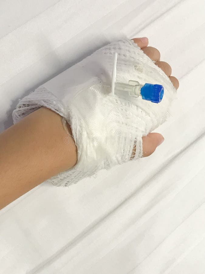 Close Up of Iv Plug in Baby Hand for Saline Stock Photo - Image of ...