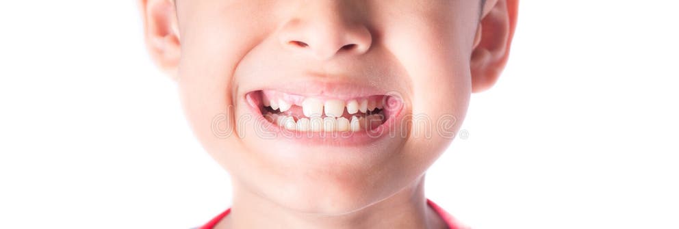 6,719 Toothless Stock Photos - Free & Royalty-Free Stock Photos from ...