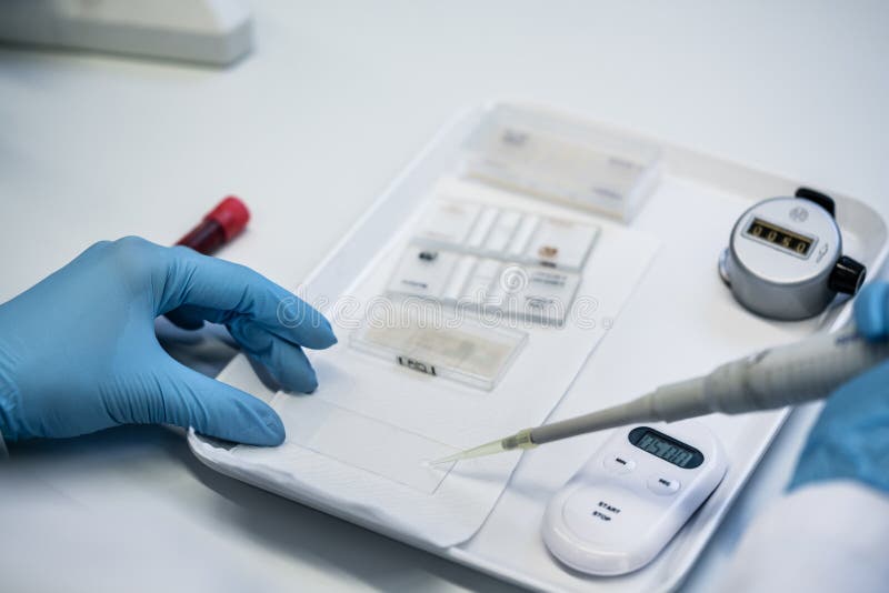 Close Up of Lab Technician Preparing Blood Test Stock Image - Image of ...