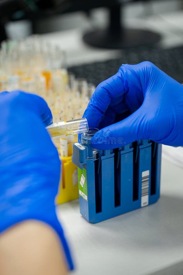 A Close-up of Laboratory Tests in a Test Tube Stock Photo - Image of ...