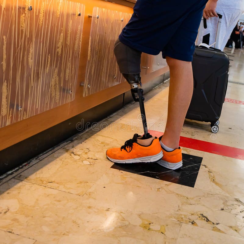 Close-up of Legs of Man with Bionic Prosthesis at Airport. Stock Photo ...