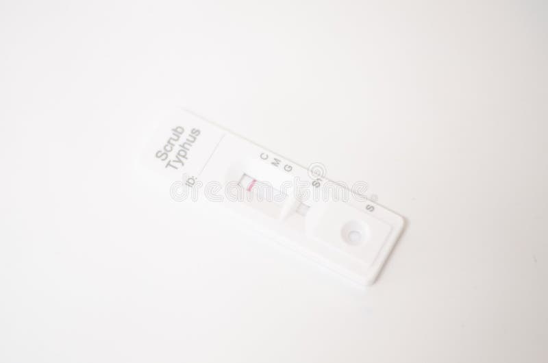 Close Up Lepto-abtesting in Lab Stock Photo - Image of pharmacology ...