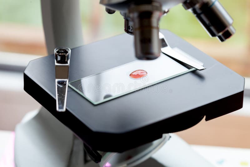 Close Up Macro Microscope with Blood Sample in the Laboratory Stock ...