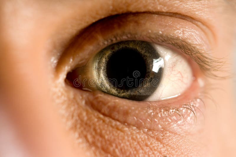 Close Up of a Man`s Eye Ball Stock Photo - Image of person, medical ...