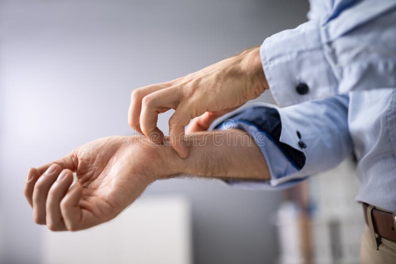 4,146 Hand Scratching Photos - Free & Royalty-Free Stock Photos from ...