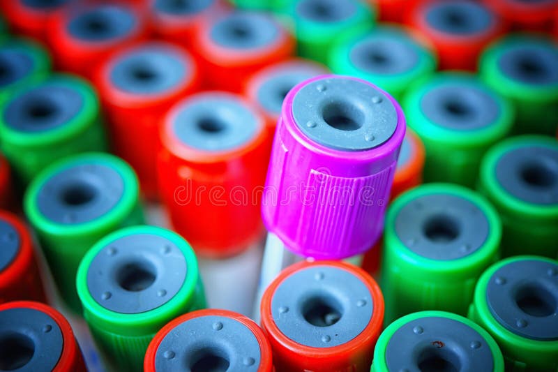 Close Up Medical Test-tube with Blood Samples Stock Photo - Image of ...