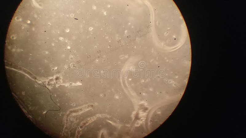 Close Up of Micro Organisms or Microbes in Microscop Magnification ...