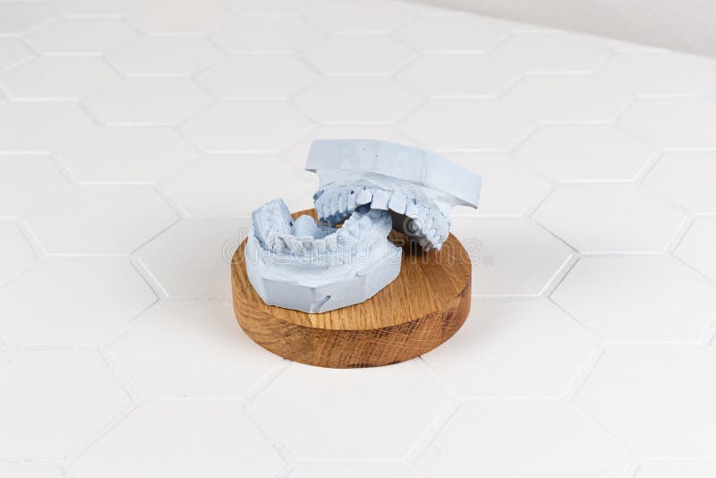 Close-up of a Modern Model of Human Jaws on a Light White Background ...