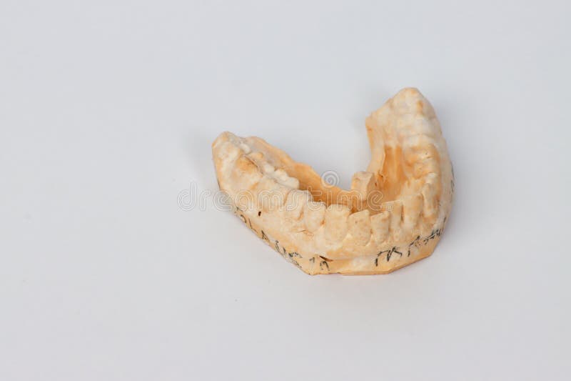 Close Up of an Mold of a Man’s Lower Teeth Stock Photo - Image of mold ...