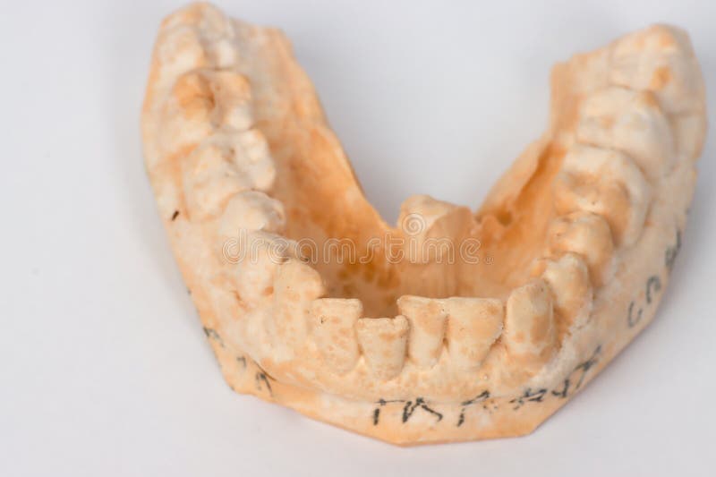 Close Up of an Mold of a Man’s Lower Teeth Stock Photo - Image of mouth ...