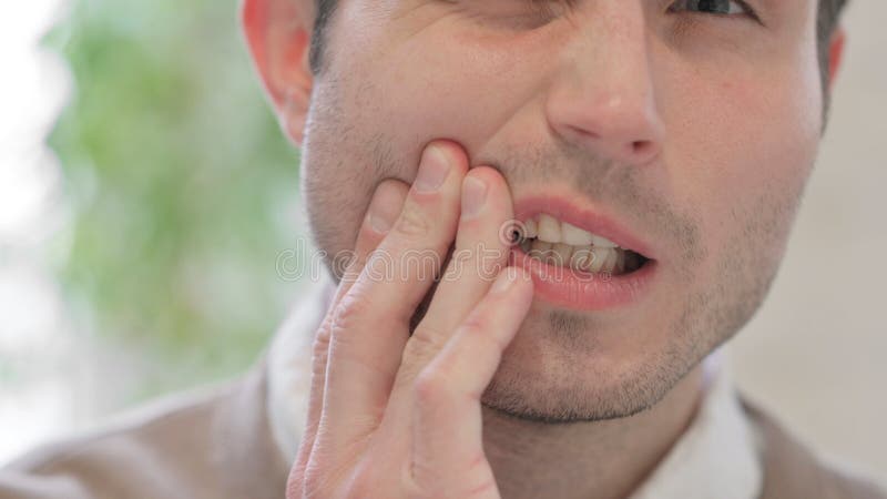 Close Up of Mouth of Man Having Cavity, Toothache Stock Photo - Image ...
