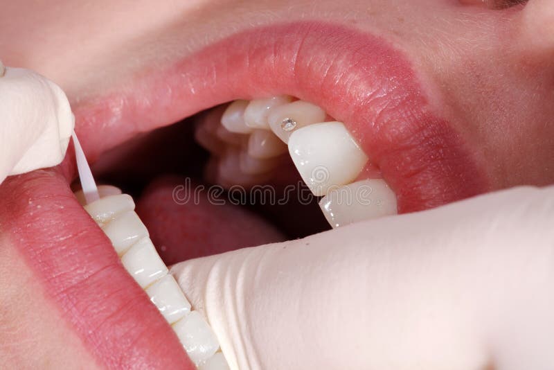 Close-up mouth and teeth stock photo. Image of natural - 39468880