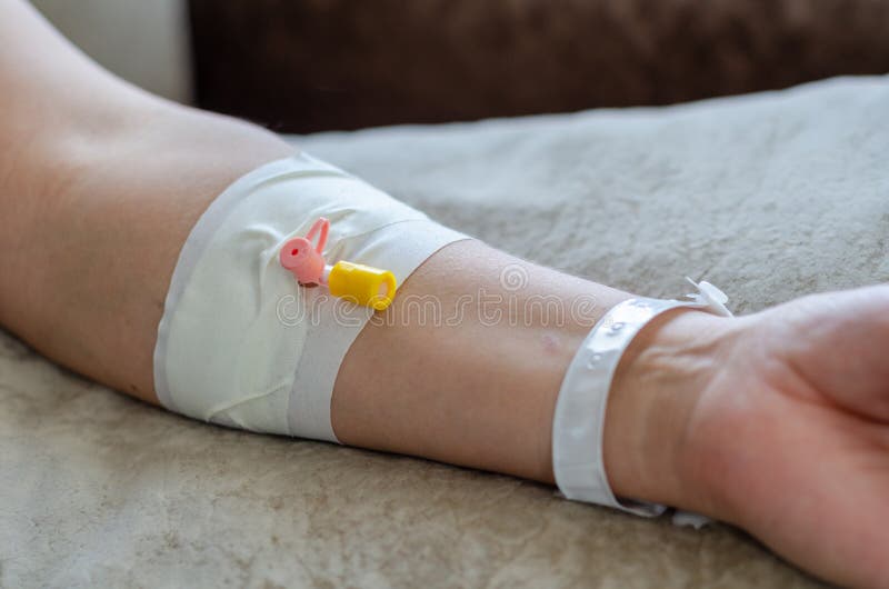 Patients hand with an IV stock photo. Image of health - 162574138