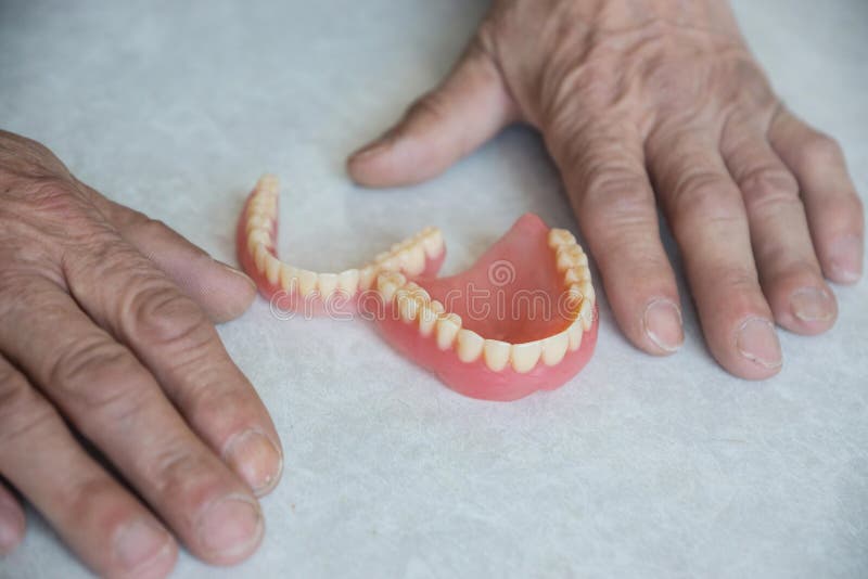 Removable Dentures for the Patient are Made in a Dental Laboratory ...
