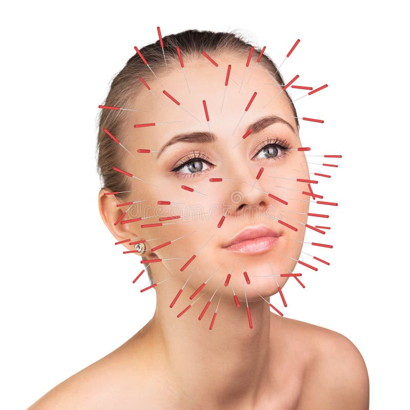 Close-up of Performing Acupuncture Therapy on Face Stock Photo - Image ...