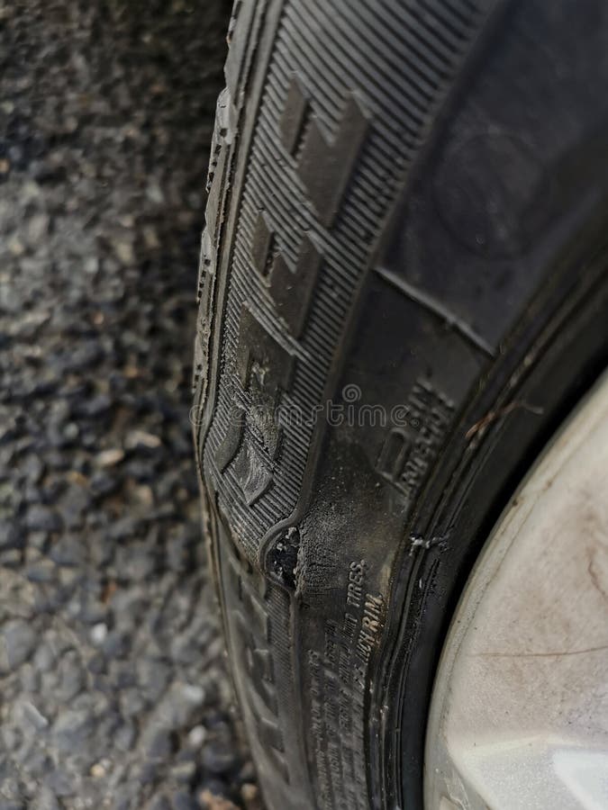 Close-up Swelling of the Tongue. Allergic Reactions, Infections ...