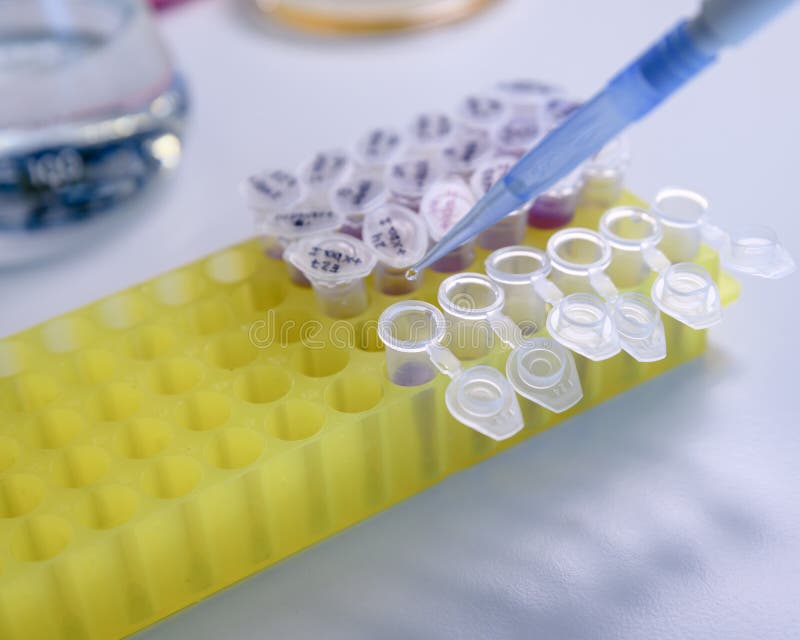 Close-up Pipette with Drop of Liquid Over Rack of Plastic Tubes for DNA ...