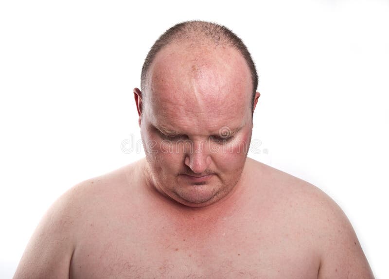 Close Up Portrait Capture of Overweight Male Stock Photo - Image of ...