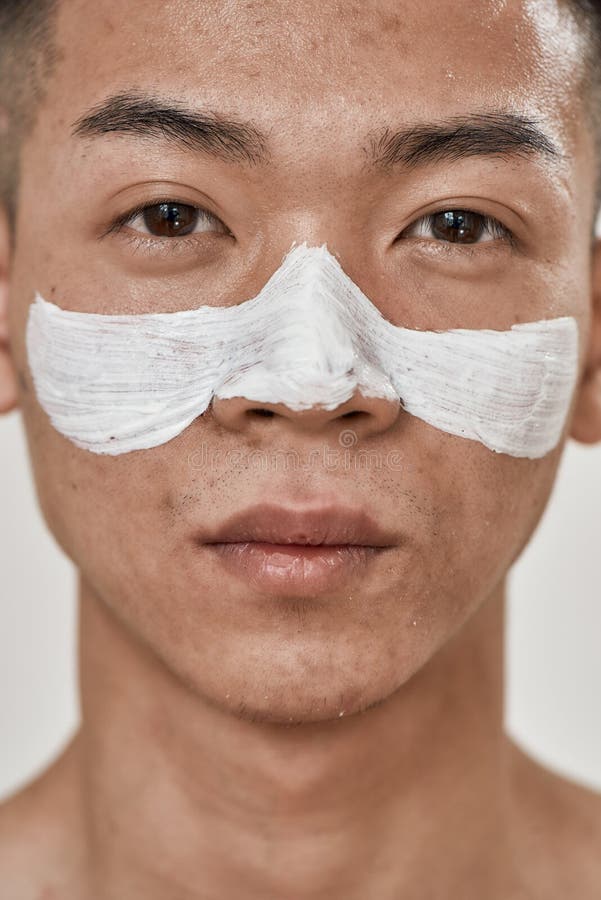 Close Up Portrait of Young Asian Man with Problematic Skin and ...