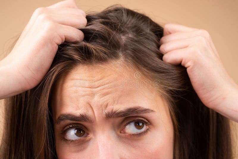 Close Up Problem Hair. Macro Hair Care and Hair Loss Concept. Stock ...