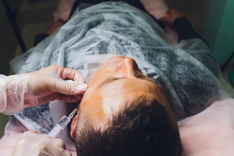 Close-up of Procedure for Face Lifting PDO Suture Operation, Face ...