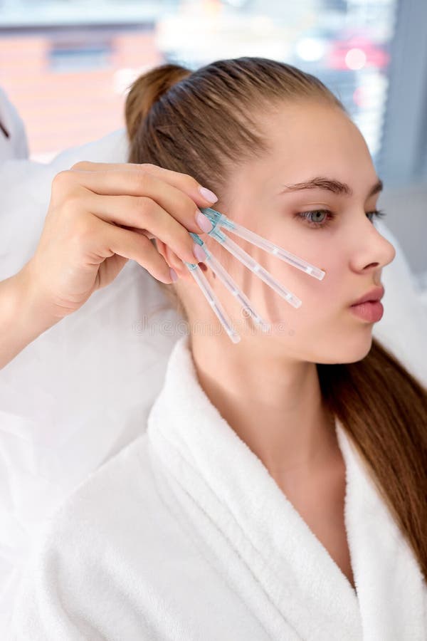 Close-up of Procedure for Face Lifting PDO Suture Operation, Face ...