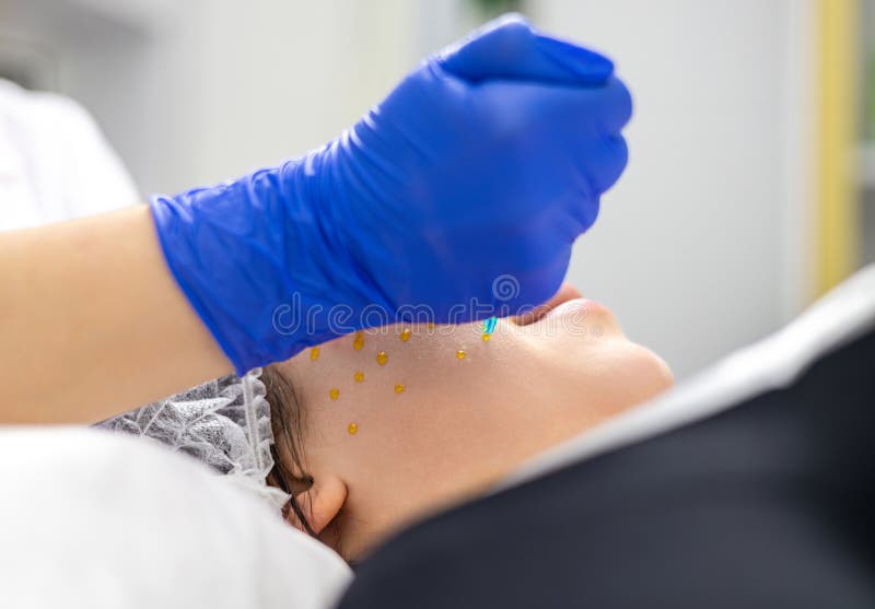 Close-up of the Process of Applying a Yellow Solution To the Client ...