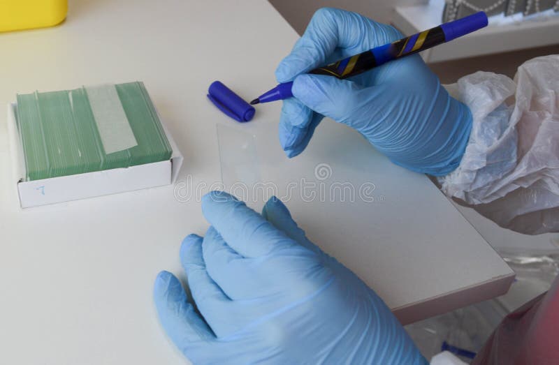 Close Up of Scientist Hand with Test Sample in Lab Stock Image - Image ...