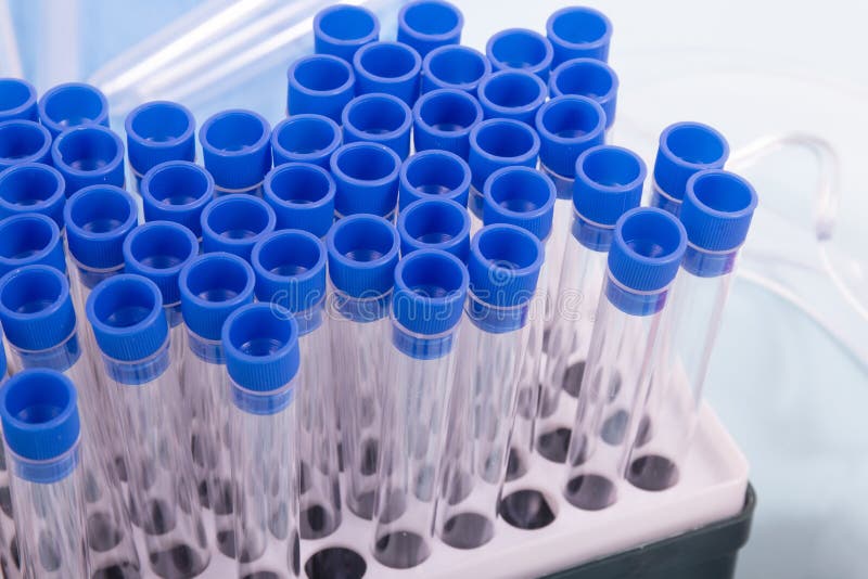 Several Laboratory Testing Tubes Stock Photo - Image of rack ...