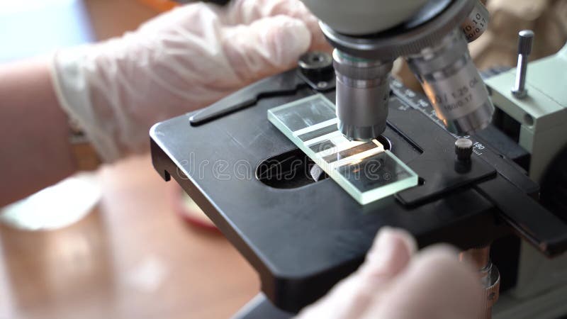 POV of a Microscope for Examining the Patient S Eyes in the Operating ...