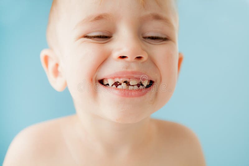 347 Baby Bad Teeth Photos - Free & Royalty-Free Stock Photos from ...