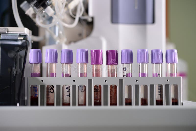 Close Up Shot of Blood Test Machine Stock Photo - Image of acid ...