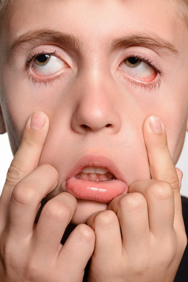 Close-up Portrait of a Young Person Making a Funny Face, Eyes Wide and ...