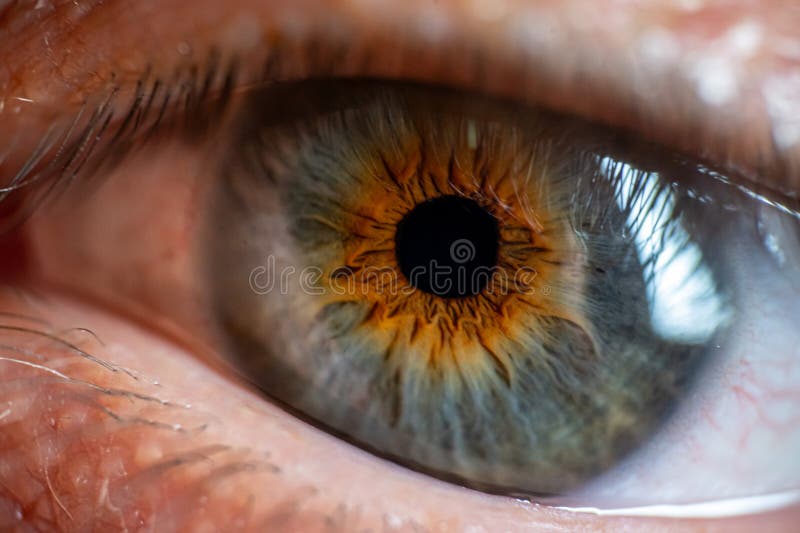 Close-up Shot of a Human Eye with a Vibrant Orange Blue Iris Staring ...