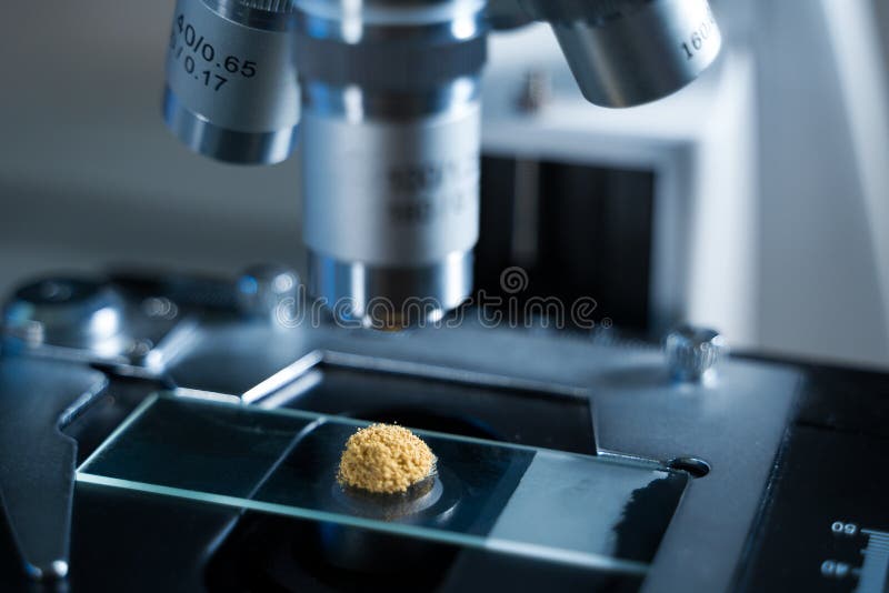 Laboratory Microscope with Mold Stock Photo - Image of bacterium ...