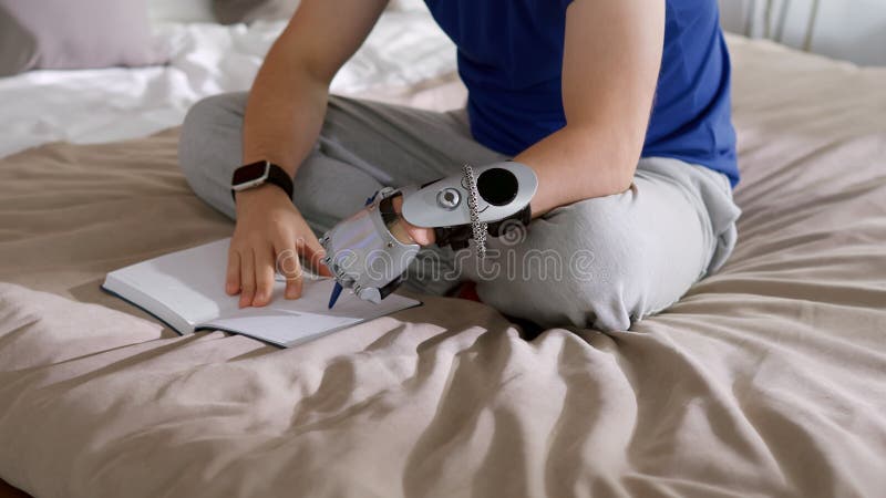 Close Up Shot of Man with Prosthetic Bionic Hand Writing with Pen in ...